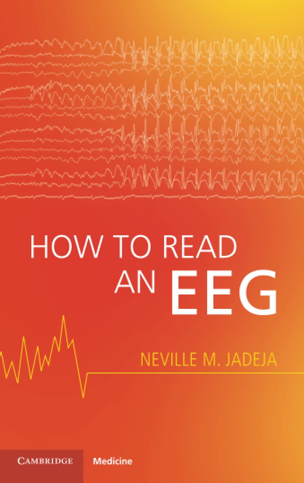 How to Read an EEG: 9781108825641: Medicine & Health Science Books ...