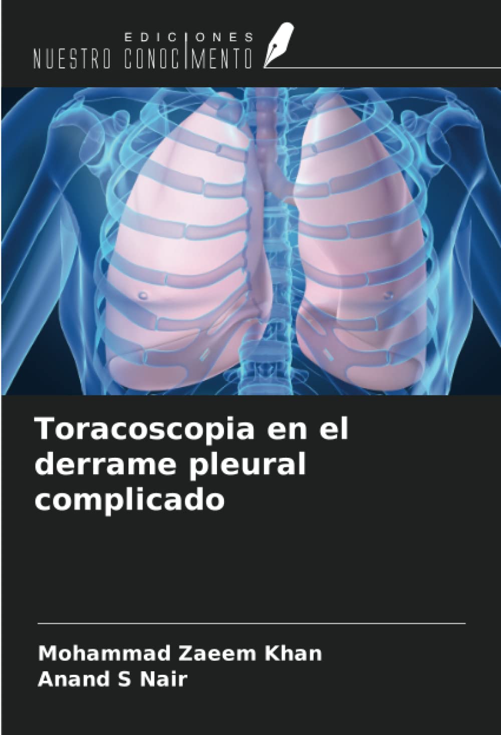 Amazon.com: Toracoscopia en el derrame pleural complicado (Spanish ...