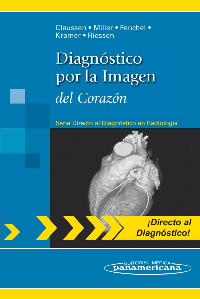 Buy Diagnostico por la imagen del corazon / Direct Diagnosis in ...