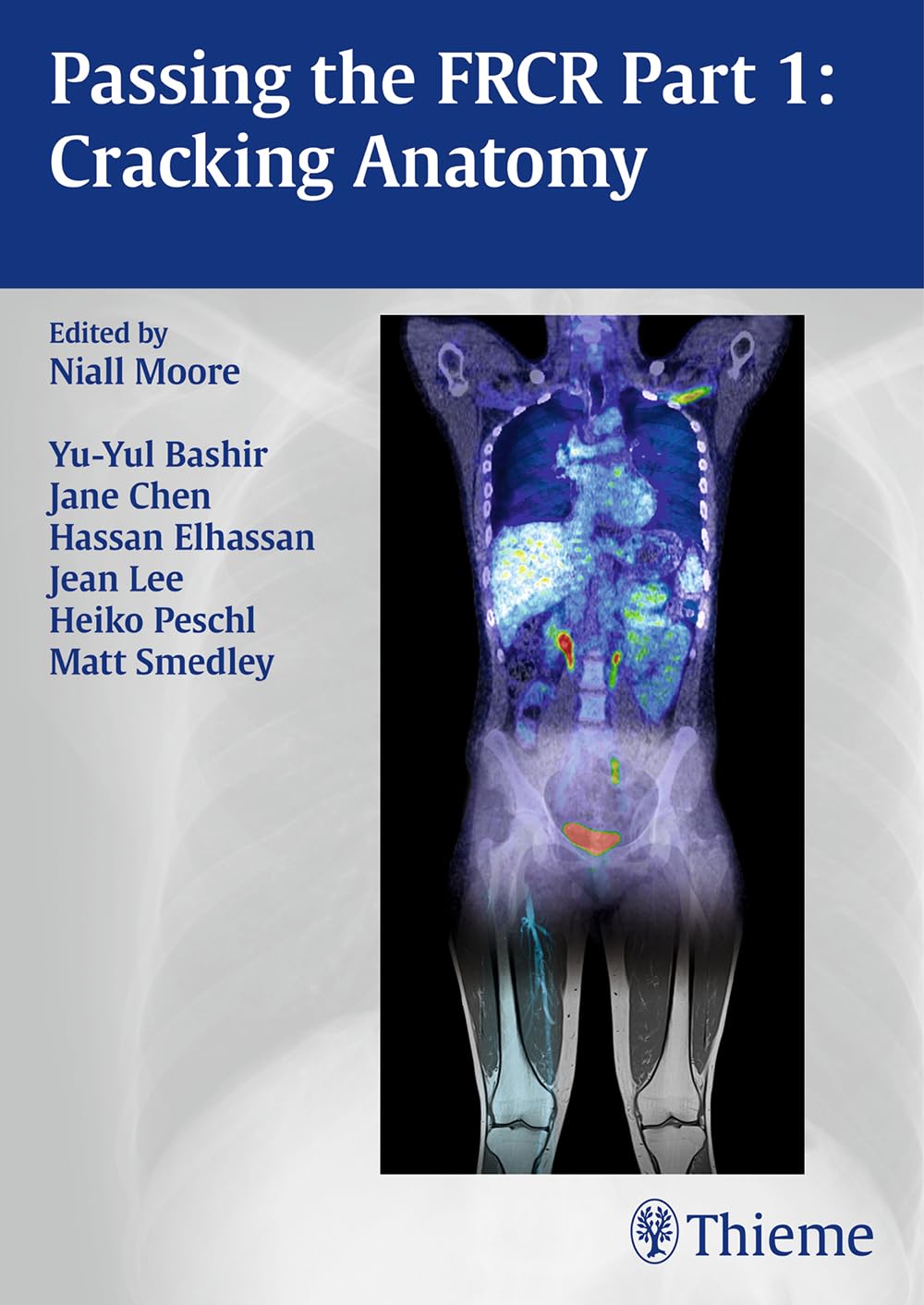 Passing the FRCR Part 1: Cracking Anatomy: 9783131987617: Medicine ...