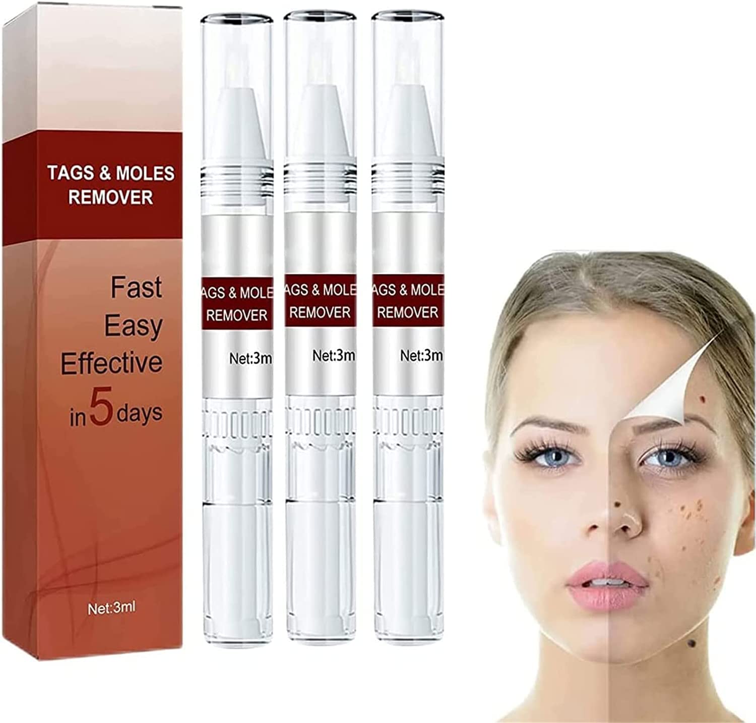 3pcs 2023 Best Wipeoff Tags & Moles Remover, Mole Remover Fast Easy ...