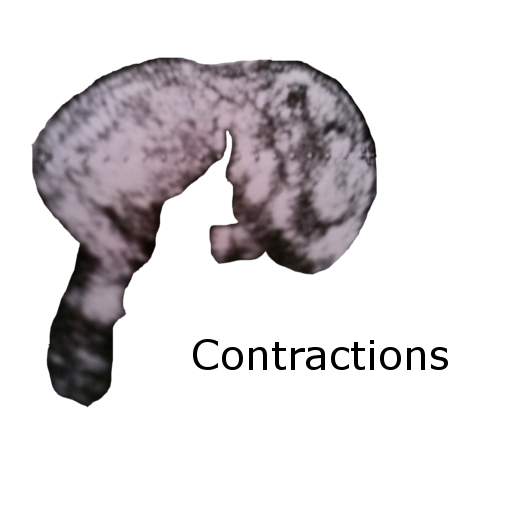 Contractions Tracker - App on Amazon Appstore