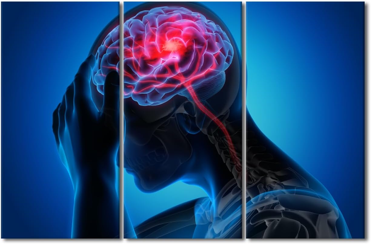 Amazon.com: 3 Panel Man with a Headache Stroke Poster Canvas Wall Art ...