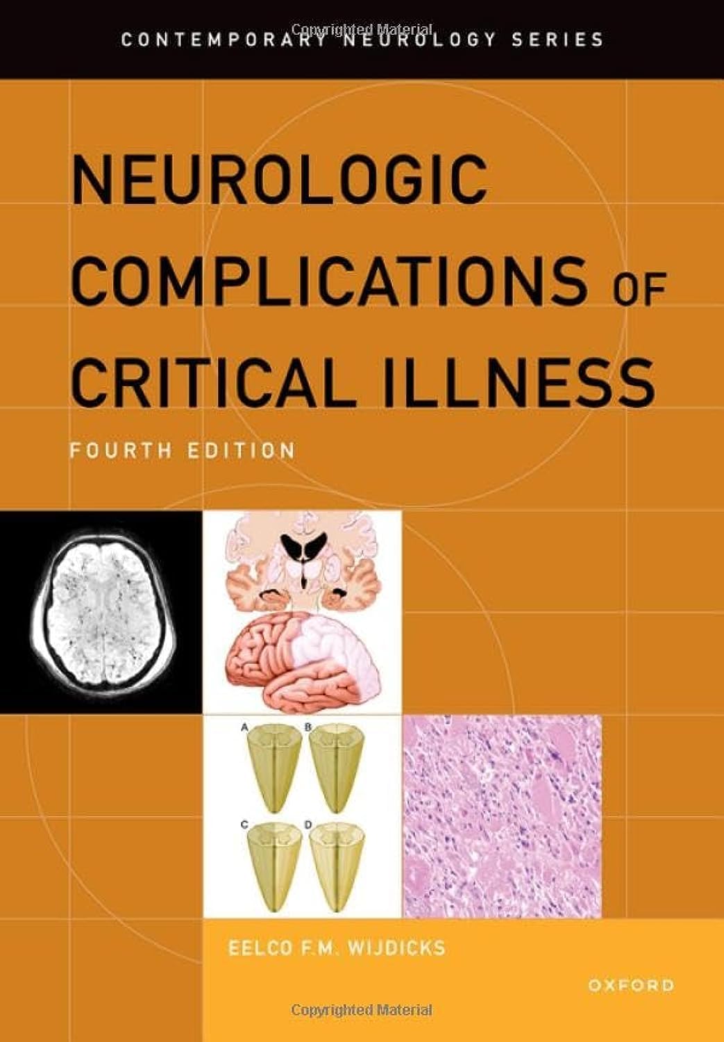 Neurologic Complications of Critical Illness (CONTEMPORARY NEUROLOGY ...