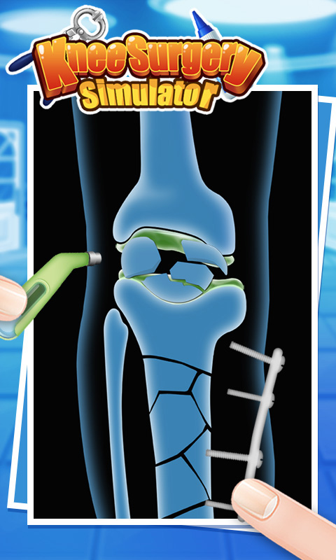 Knee Surgery Simulator - Surgeon Games - App on Amazon Appstore