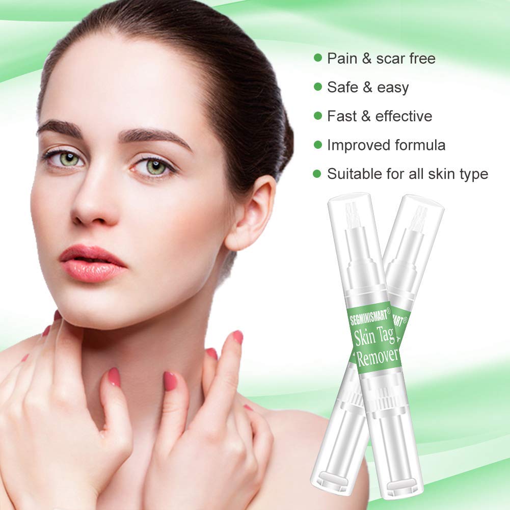 Skin Tag Remover Mole Correcter Skin Tag Removal Solution Fast ...