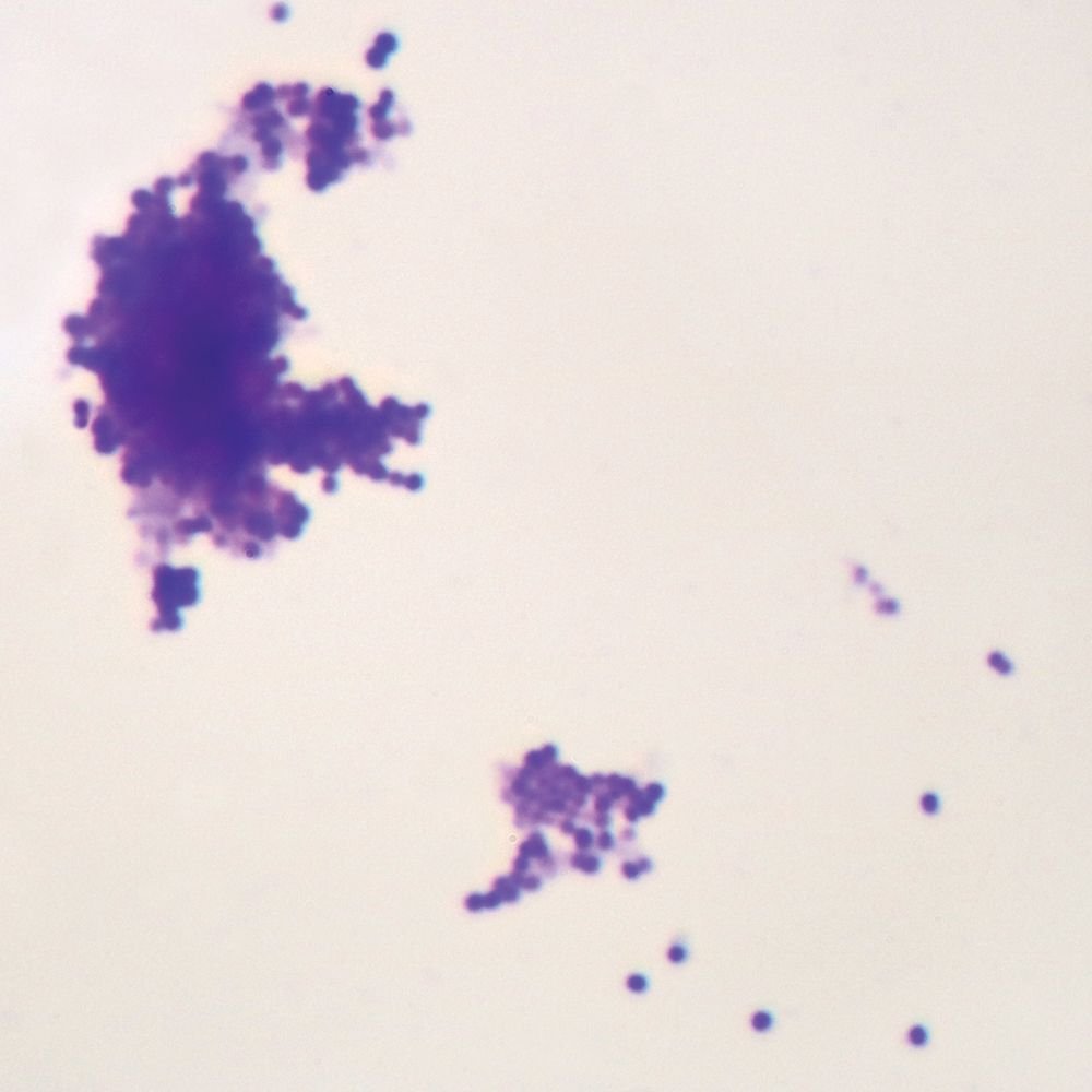 Staphylococcus Epidermis Epidermidi