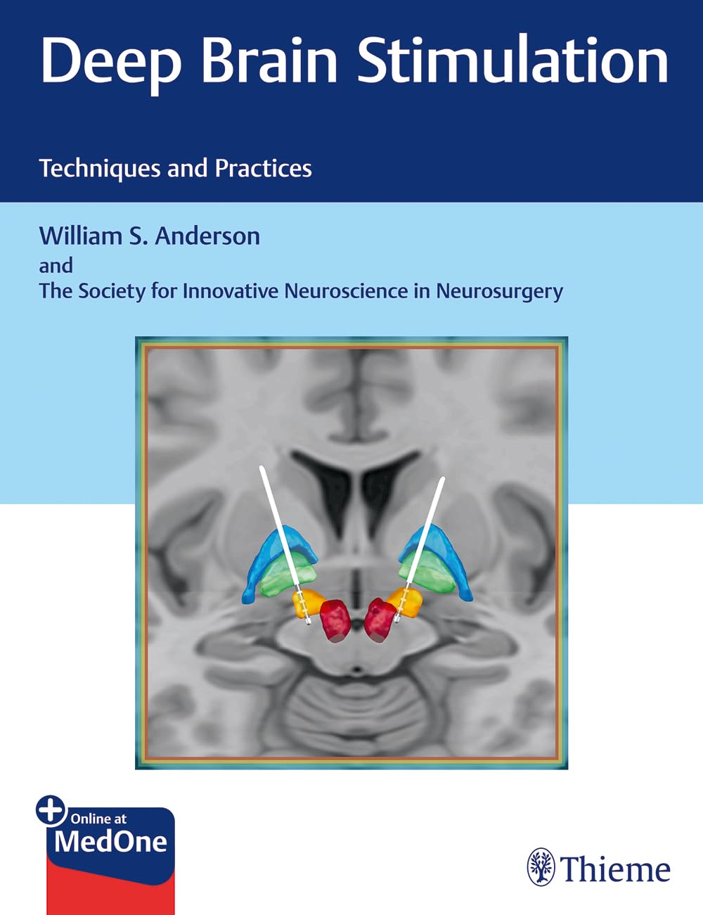 Deep Brain Stimulation: Techniques and Practices: 9781626237971 ...