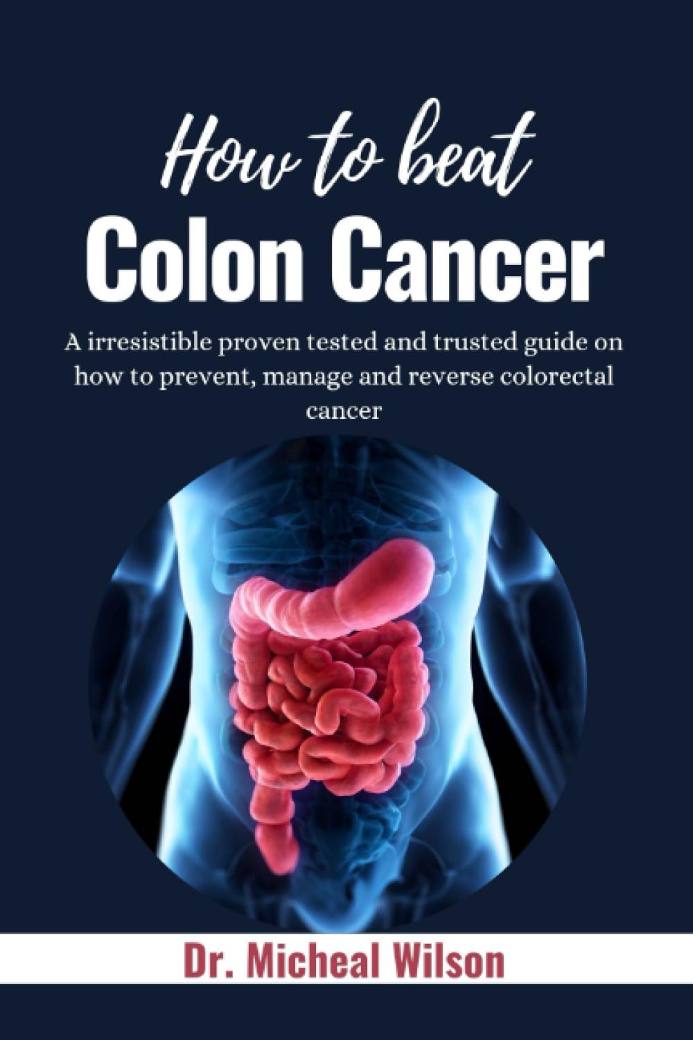HOW TO BEAT COLON CANCER: A irresistible proven and tested guide on how ...