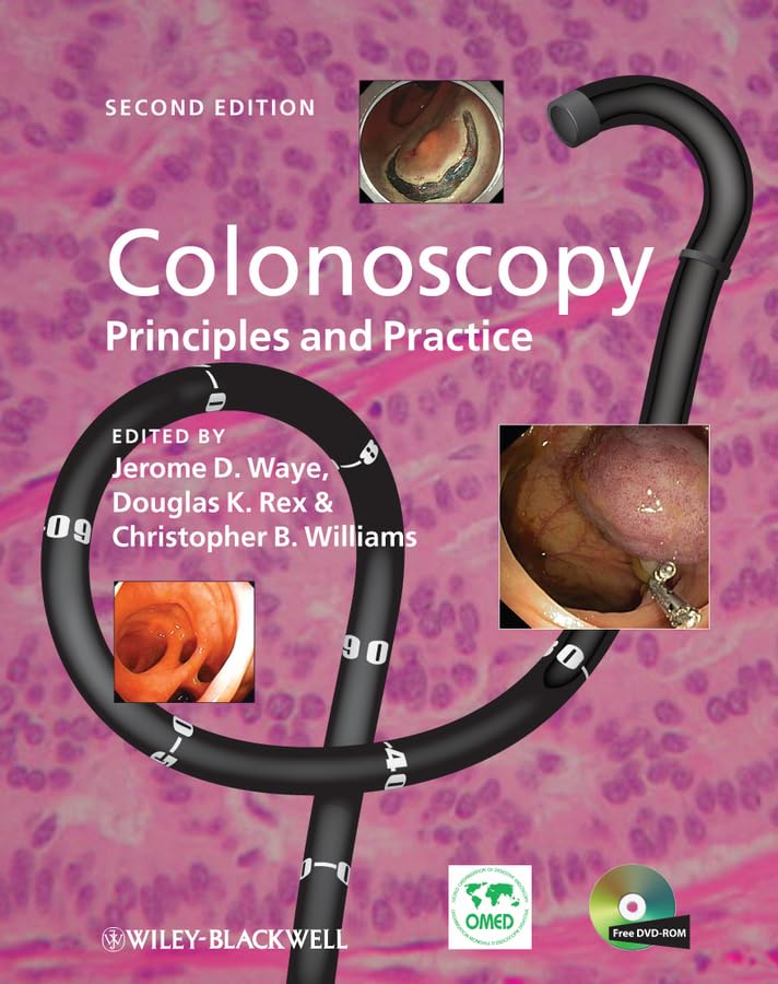 Colonoscopy: Principles and Practice: Waye, Jerome D., Rex, Douglas K ...