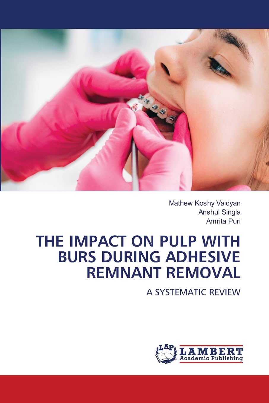 THE IMPACT ON PULP WITH BURS DURING ADHESIVE REMNANT REMOVAL: A ...