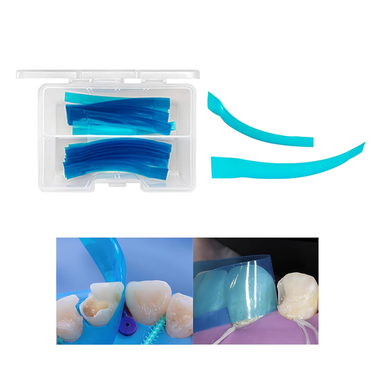 Bandas dentales de la matriz, banda contorneada seccional dental de la ...