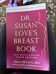 Dr. Susan Love's Breast Book (A Merloyd Lawrence Book): Love MD, Susan ...