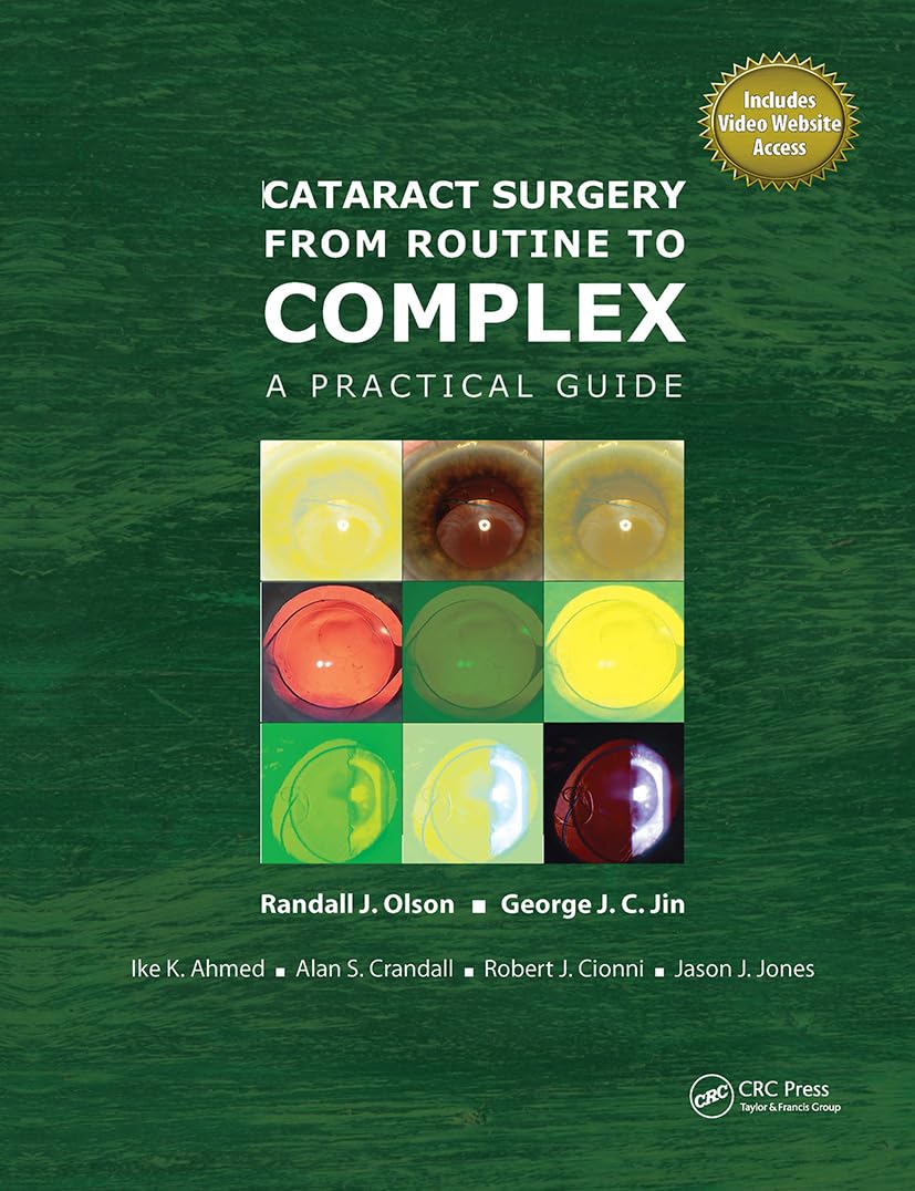 Cataract Surgery from Routine to Complex: A Practical Guide ...