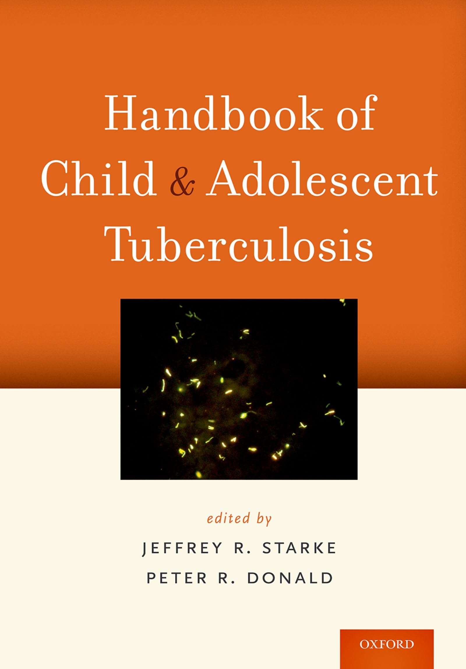 Buy Handbook of Child and Adolescent Tuberculosis Book Online at Low ...