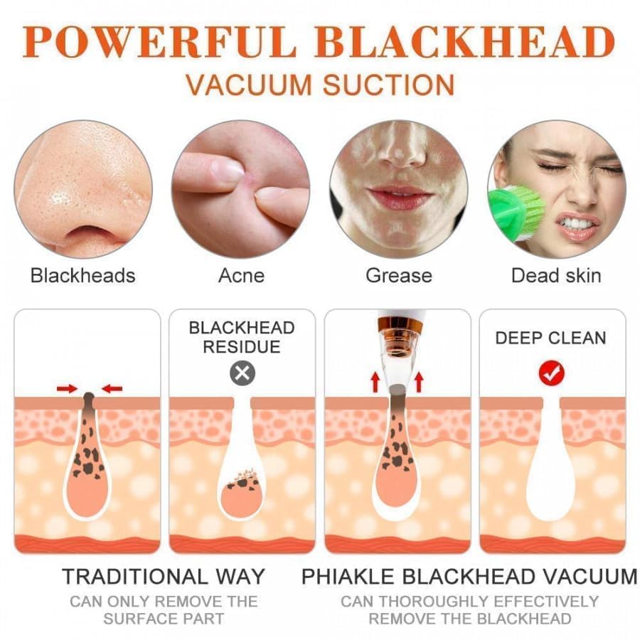 6 in 1 Multi-function Blackhead Remover Tools | Electric Derma suction ...