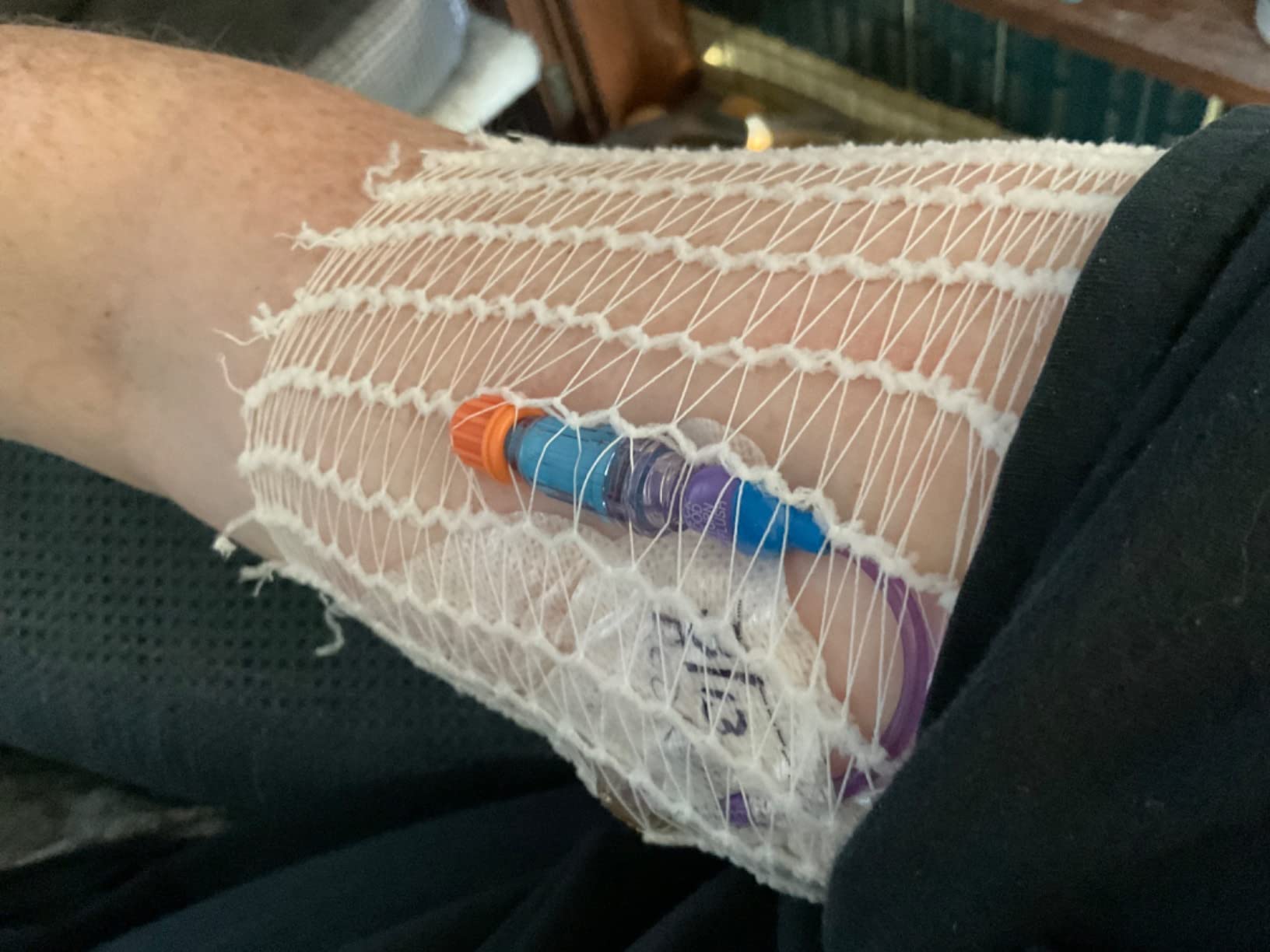 Amazon.com: ProMed Tubular Elastic Net Dressing Size 5,Fits Hand, Arm ...