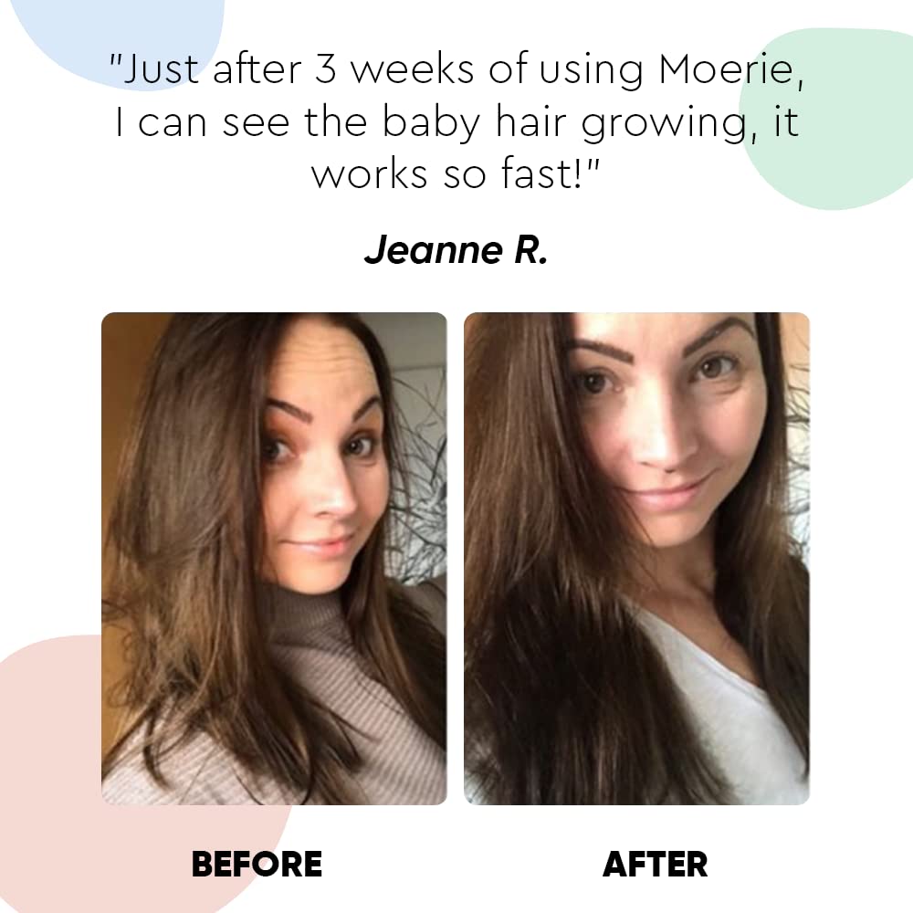 Snapklik.com : Moerie Ultimate Hair Boost Spray Designed To Strengthen ...