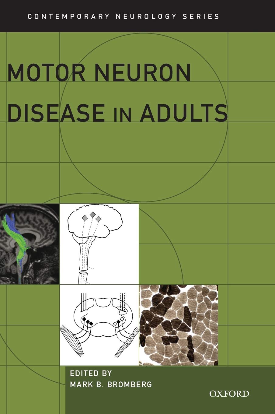 Motor Neuron Disease in Adults (Contemporary Neurology Series ...