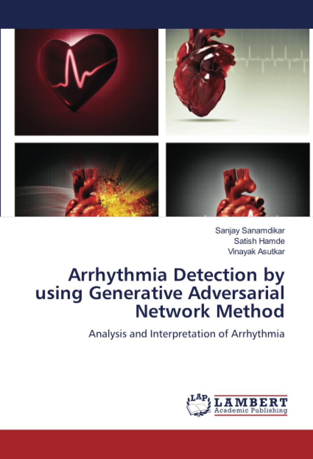 Arrhythmia Detection By Using Generative Adversarial Network Method Analysis And Interpretation