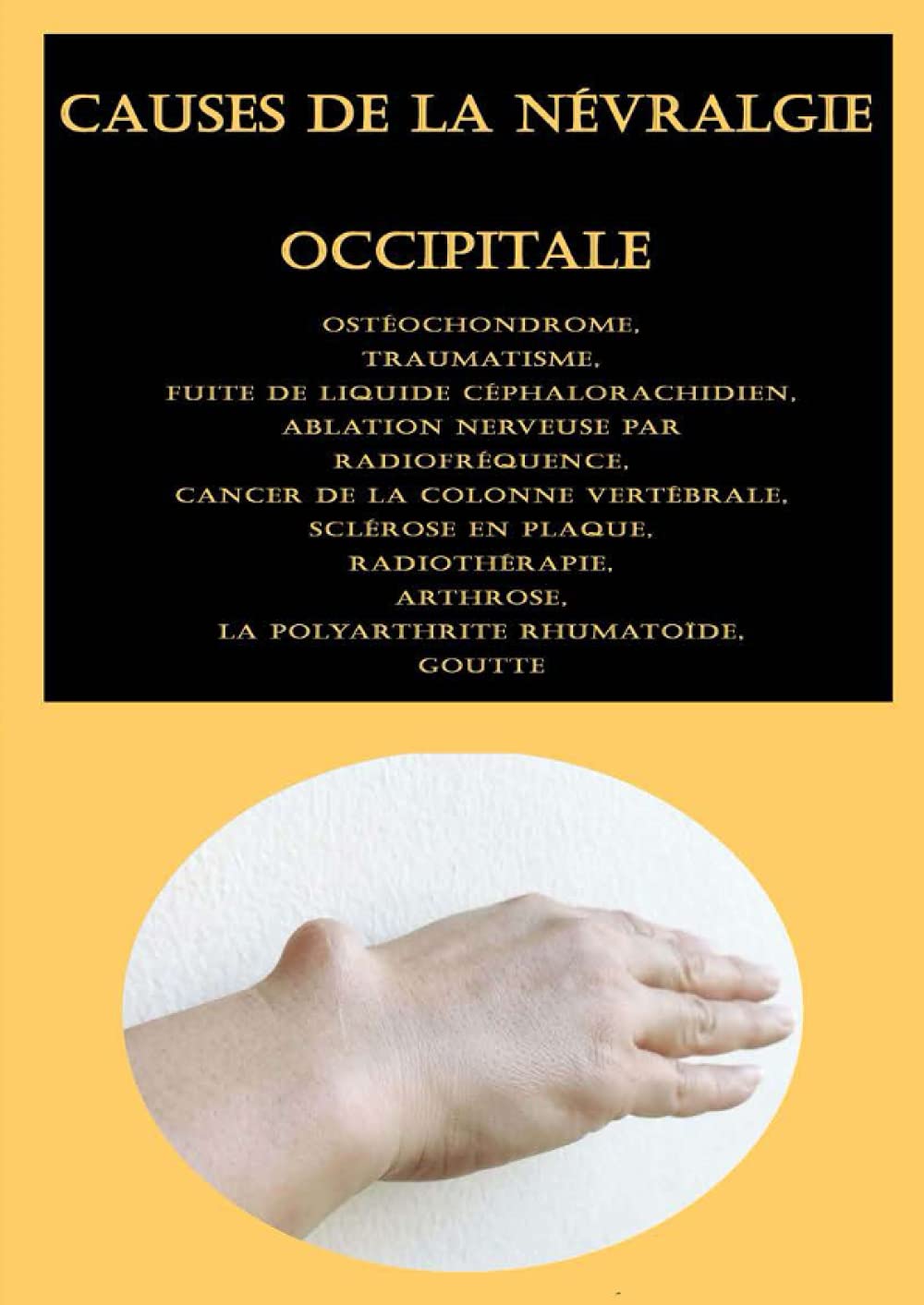 Buy Causes de la névralgie occipitale: Ostéochondrome, Traumatisme ...