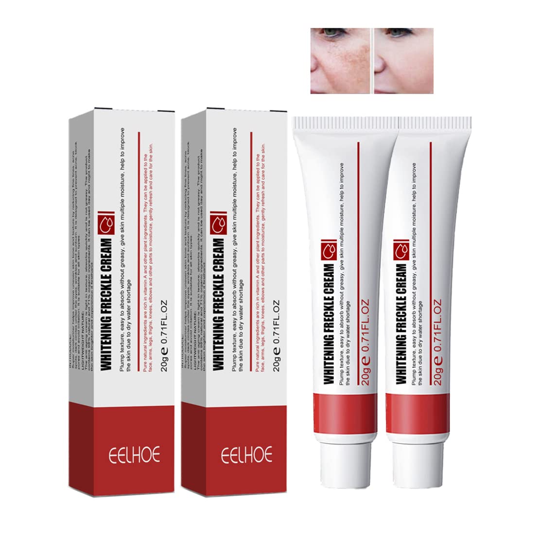 2 Pcs Whitening Freckle Cream, Spot-off Freckle Whitening Cream, Remove ...