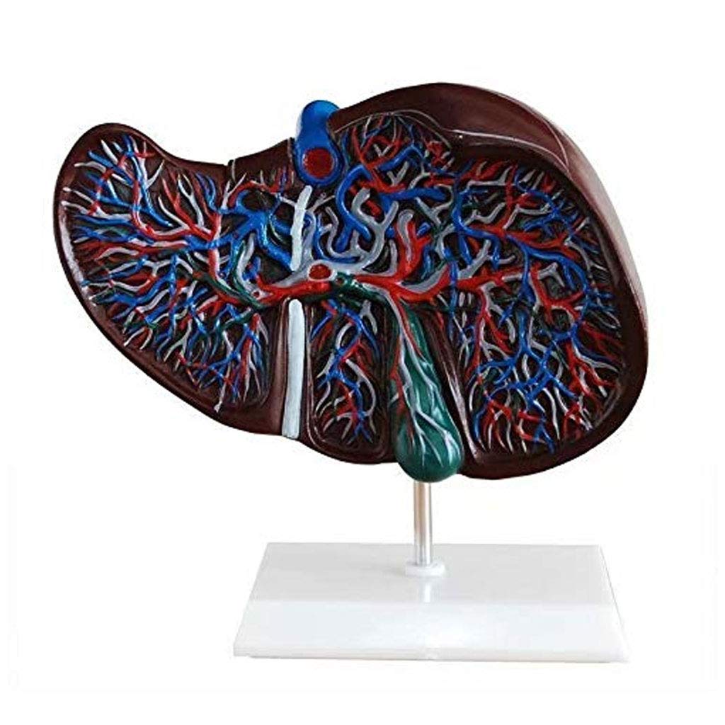 Buy YHNUJMIK Liver Anatomical Model Hepatobiliary Model Human Liver ...