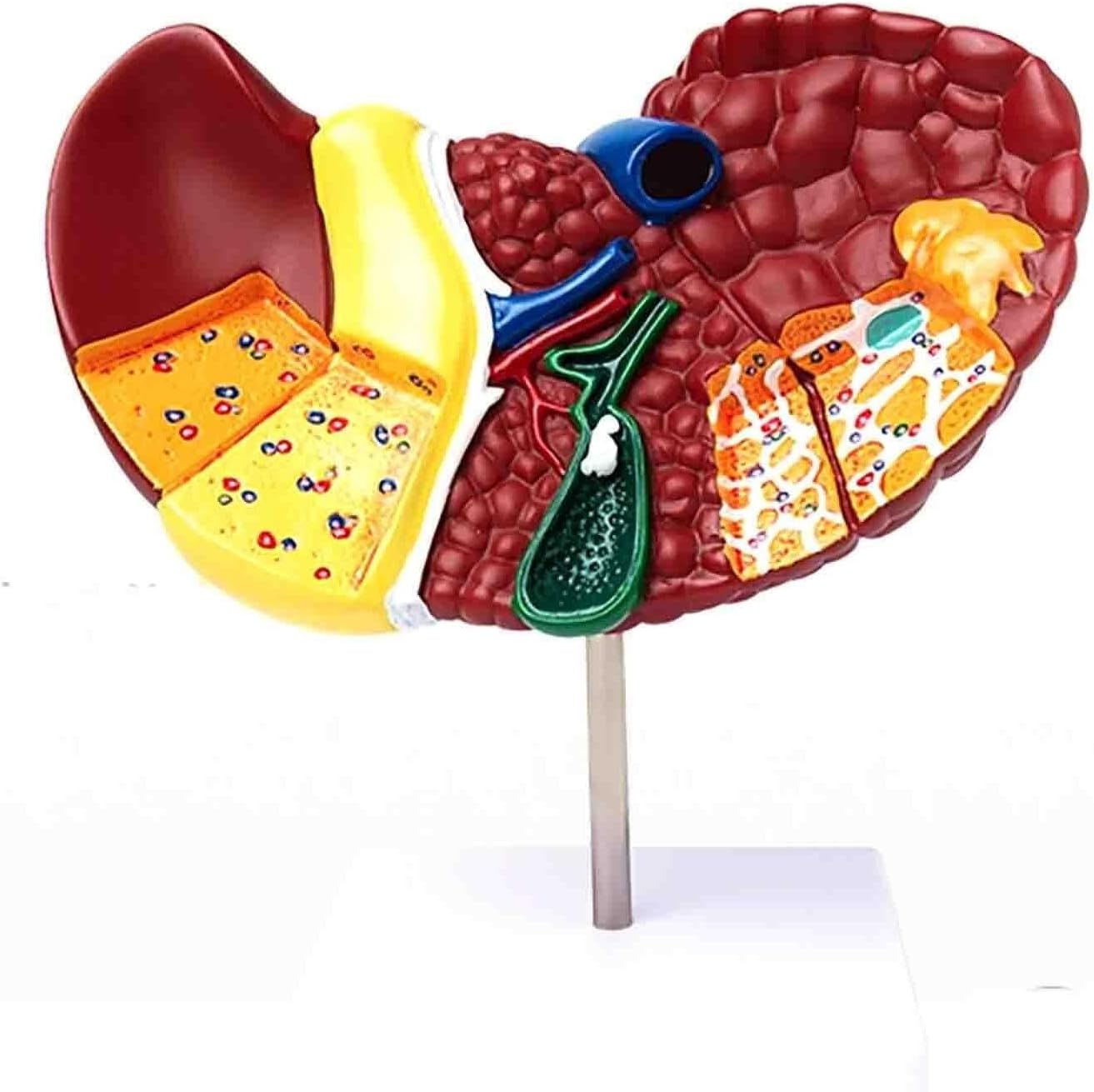 Amazon.com: HEQIM Color Liver Structure Anatomy Teaching Model, Human ...