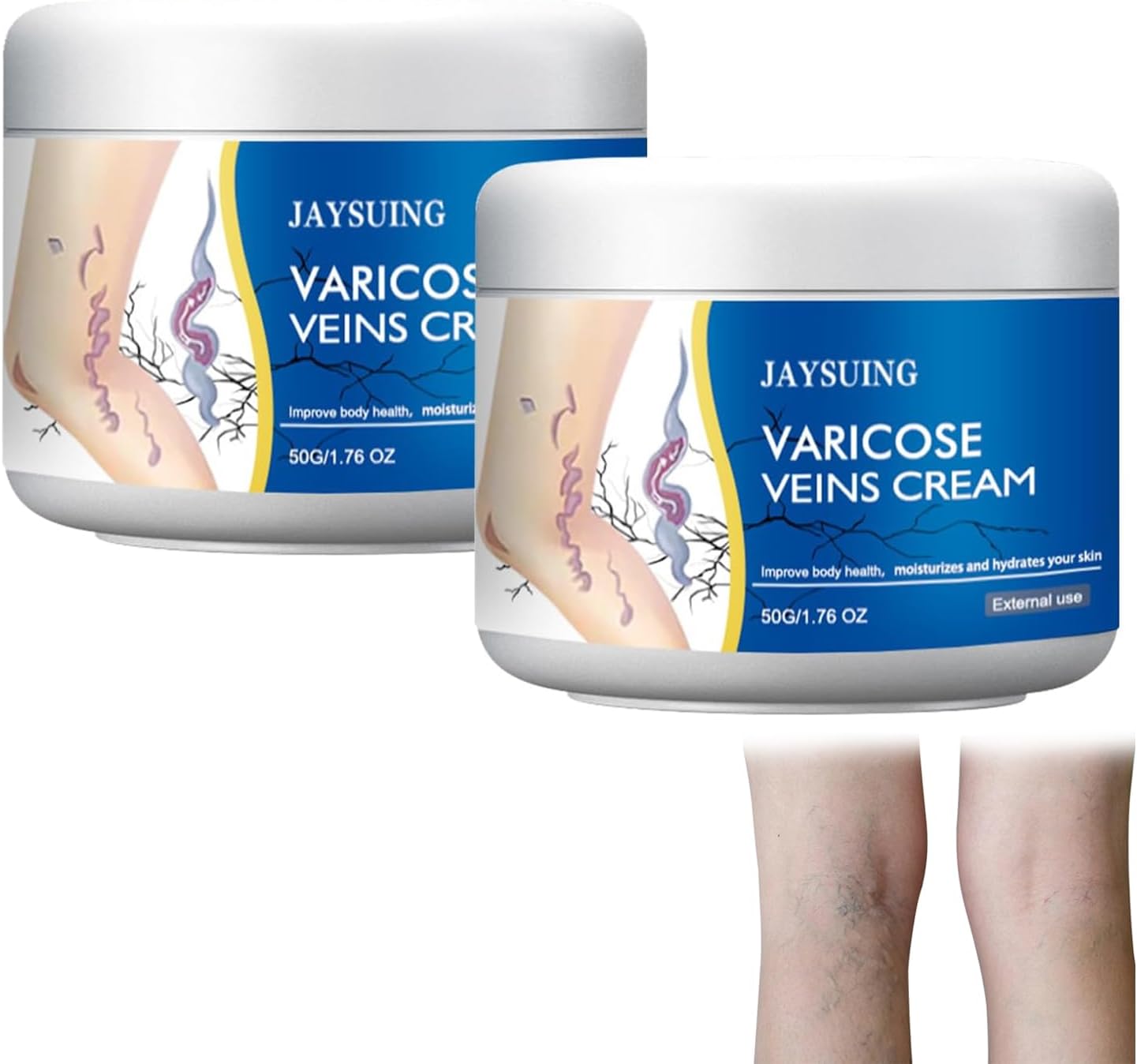 Amazon.com : Aisigeren 2PCS Varicose Vein Legs Cream,Relieve Varicose ...