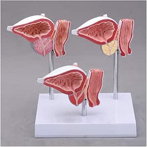 Amazon.co.jp: Prostate Lesion Model - Urogenital Medicine Educational ...
