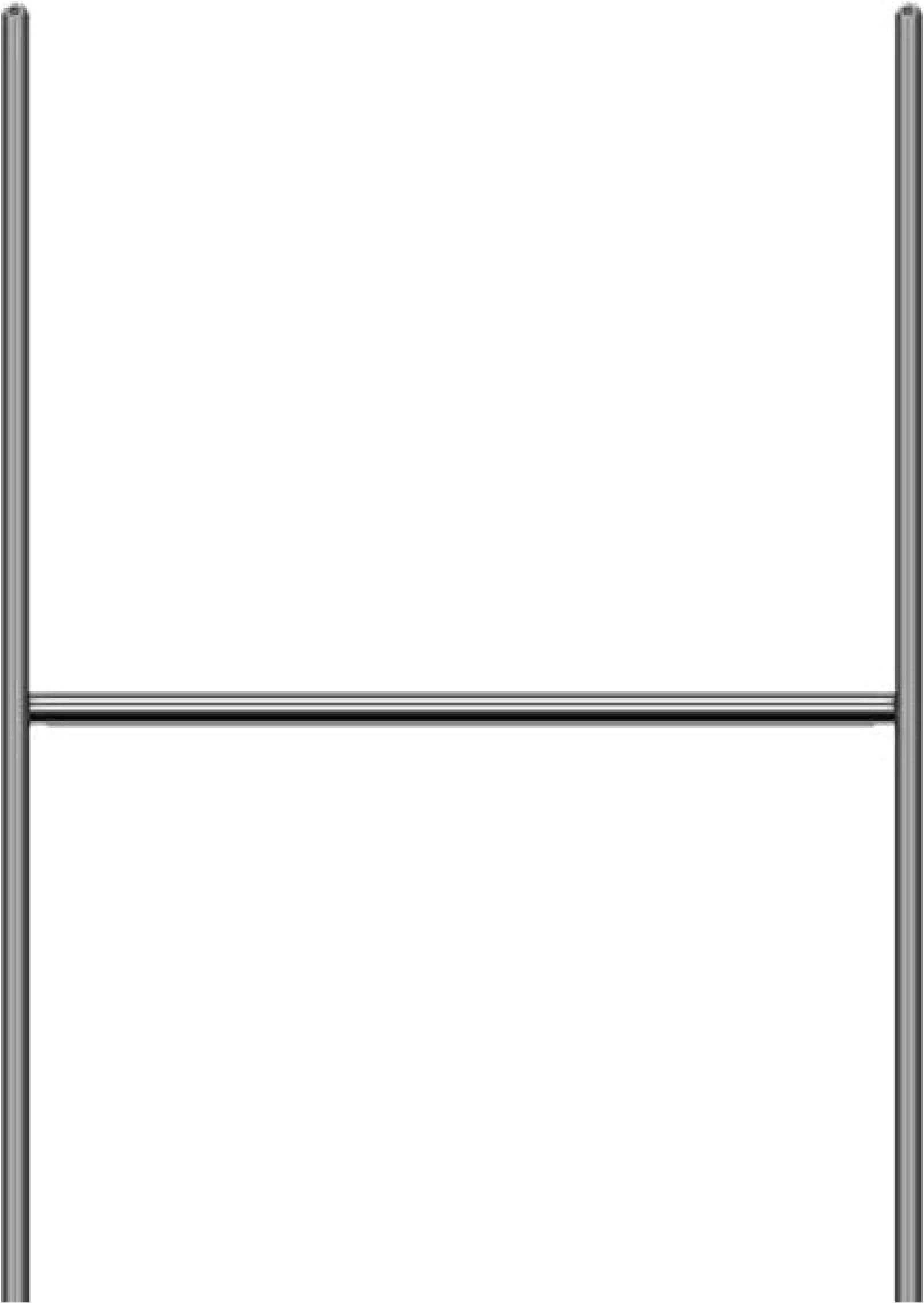 Amazon.com : 100 Pack, H-Stakes, H Frame Wire Stakes 12'' Tall and 9 ...