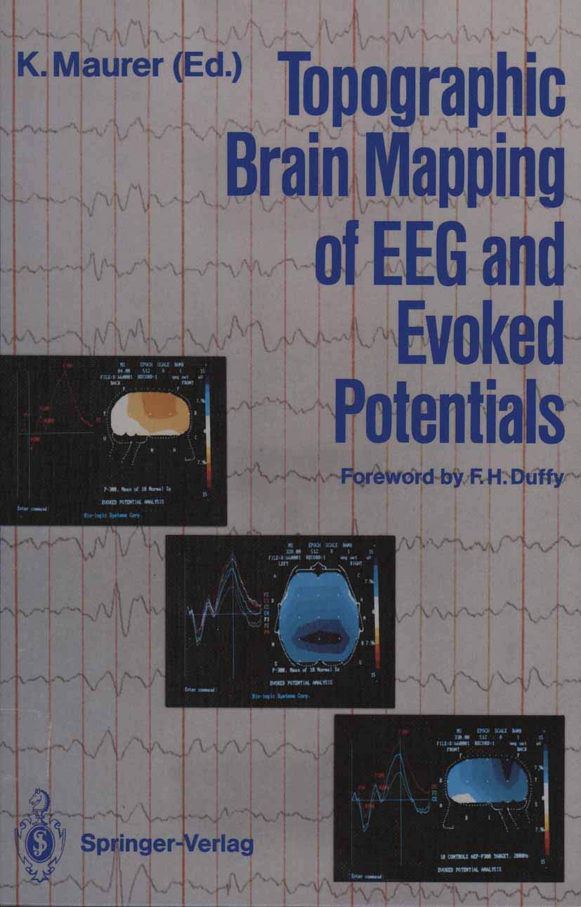 Topographic Brain Mapping of EEG and Evoked Potentials: Maurer, K ...