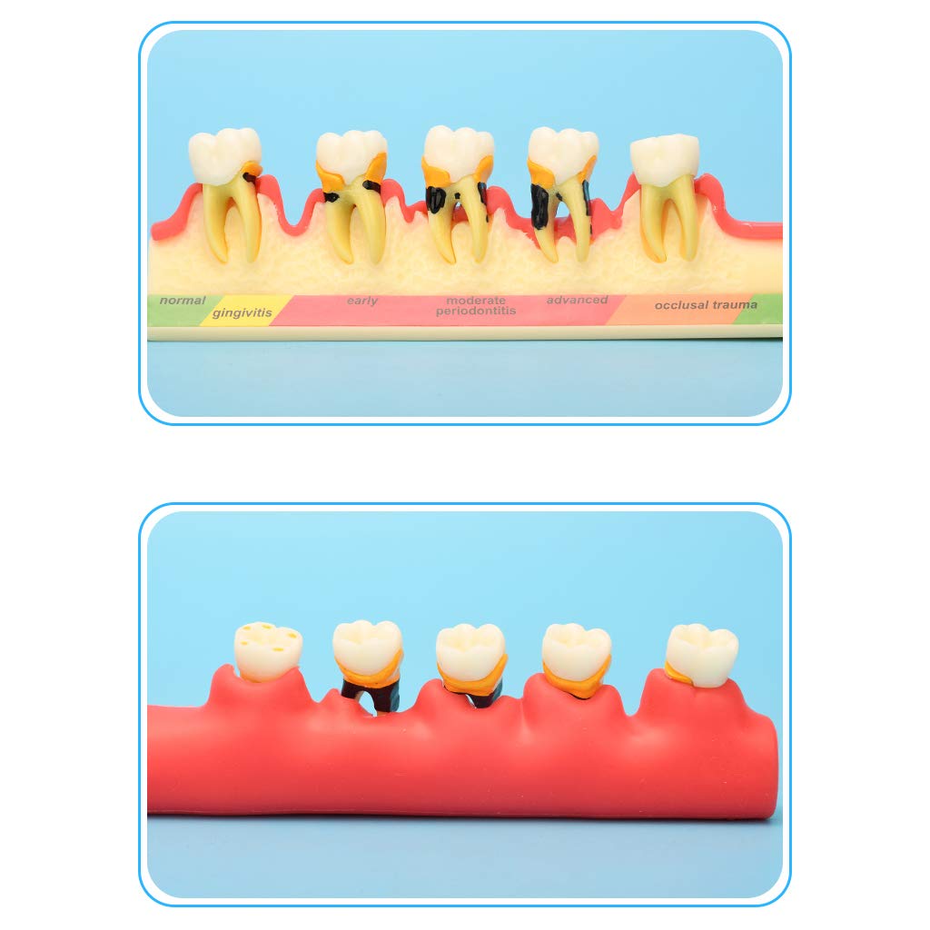 Buy QMMD Denture model Denture materials, dental nerve root canal model ...