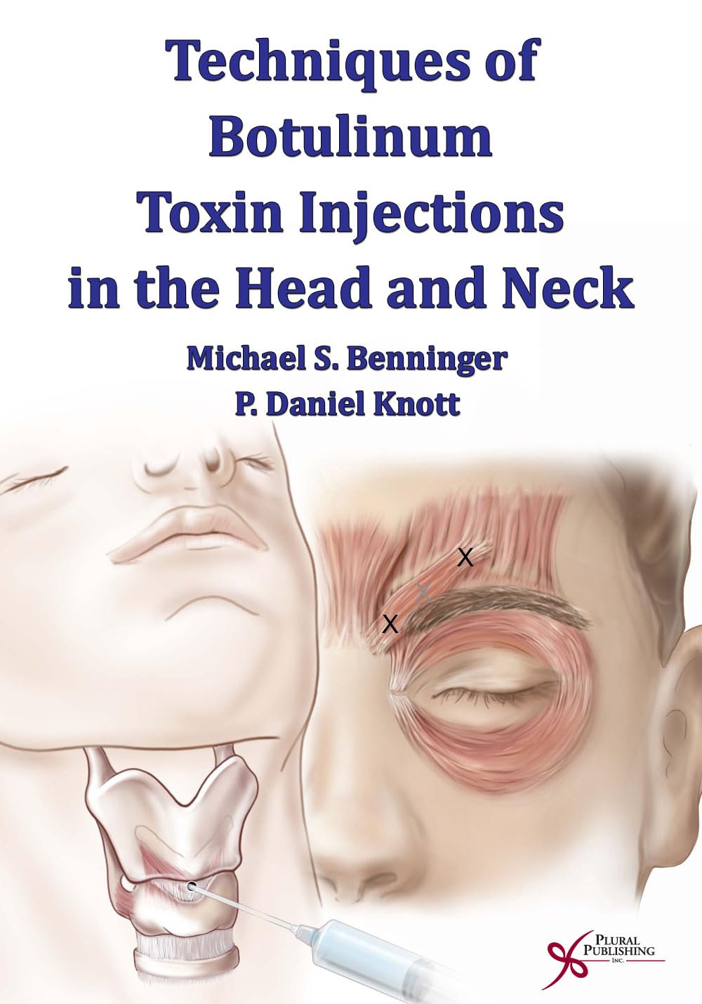 Techniques of Botulinum Toxin Injections in the Head and Neck ...
