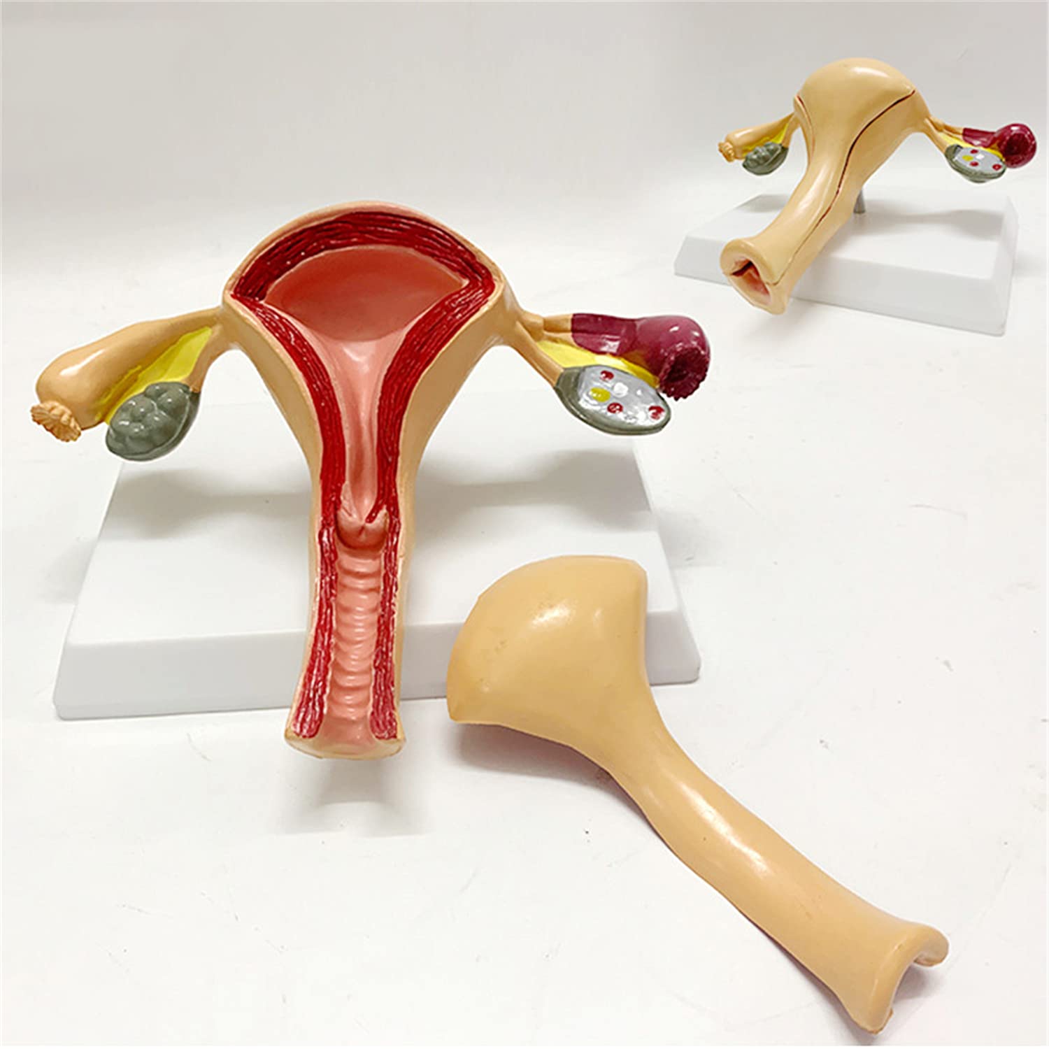 Buy BILXXY Uterine Anatomical Model Uterine Lesion Model Pathology buy-bilxxy-uterine-anatomical-model-uterine-lesion-model-pathology