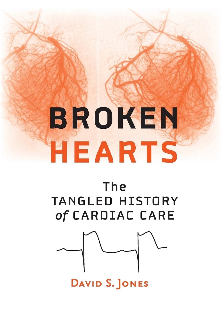 Broken Hearts: The Tangled History of Cardiac Care: Jones, David S. S ...