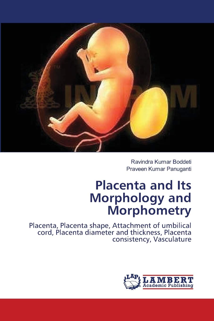 Placenta And Its Morphology And Morphometry Placenta Placenta Shape Attachment | Desertcart ...