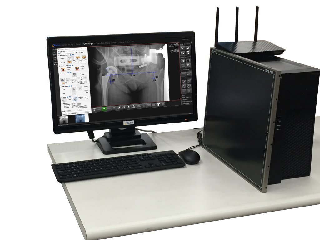 Radlink Dr Pro Wireless Direct Radiography System With Flat Panel ...