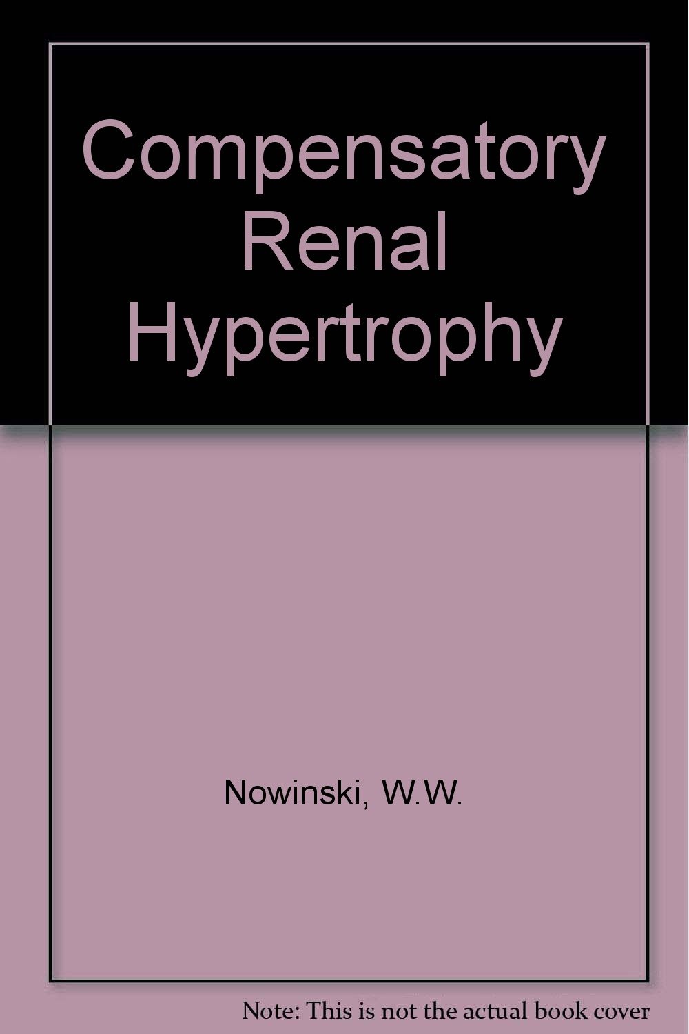 Compensatory Renal Hypertrophy: U.S. Academic Press Inc.: 9780125227506 ...