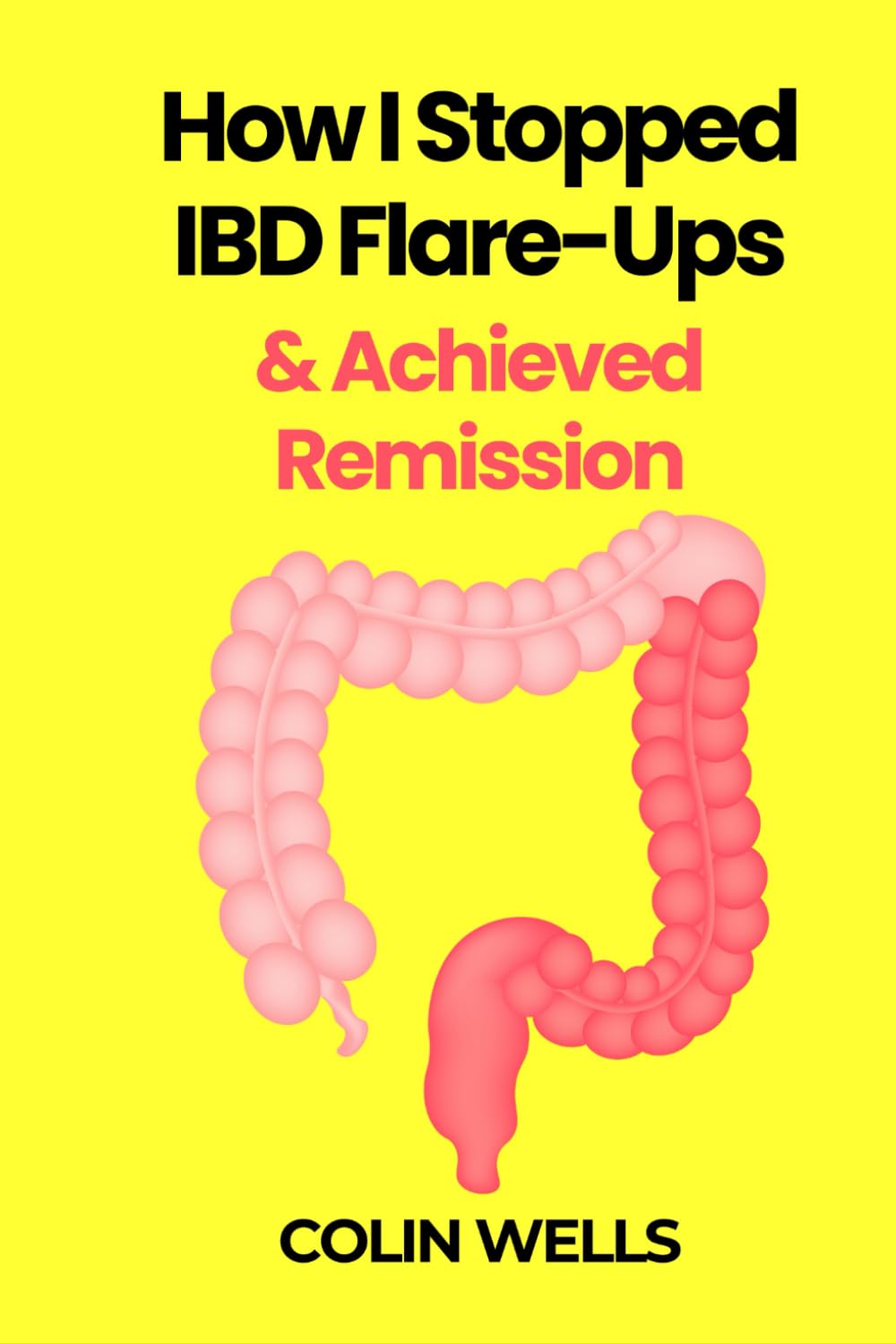 How I Stopped IBD Flare-Ups & Achieved Remission - How To Heal Crohn’s ...