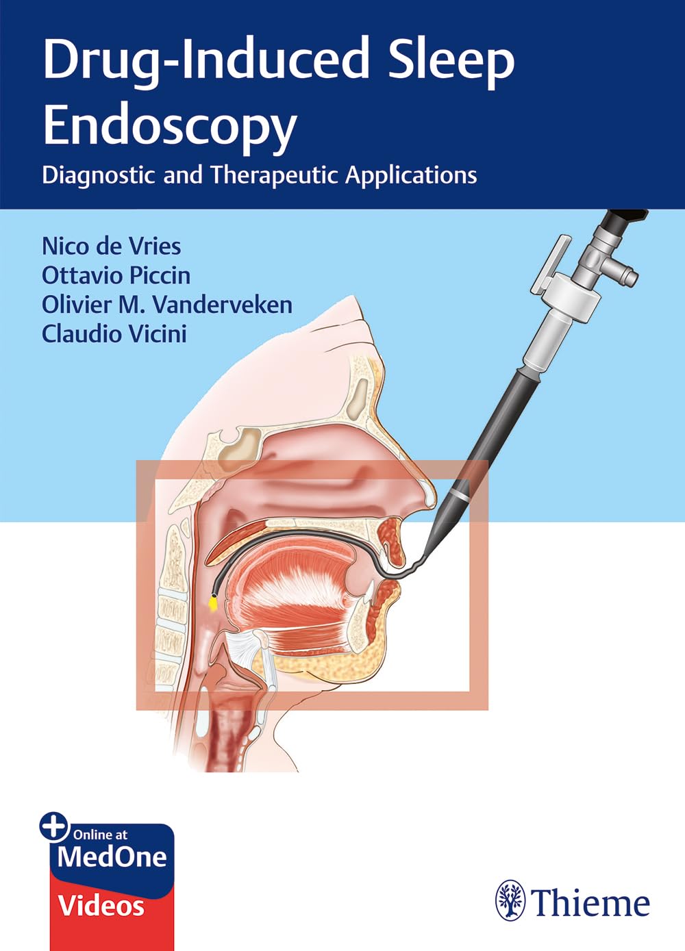 Snapklik.com : Drug-Induced Sleep Endoscopy: Diagnostic And Therapeutic ...