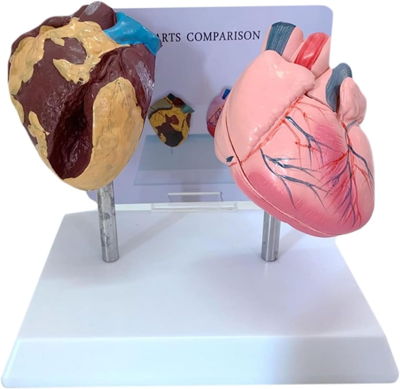 Amazon.com: Mavdecll Comparative Model of Healthy Heart and Smoking ...