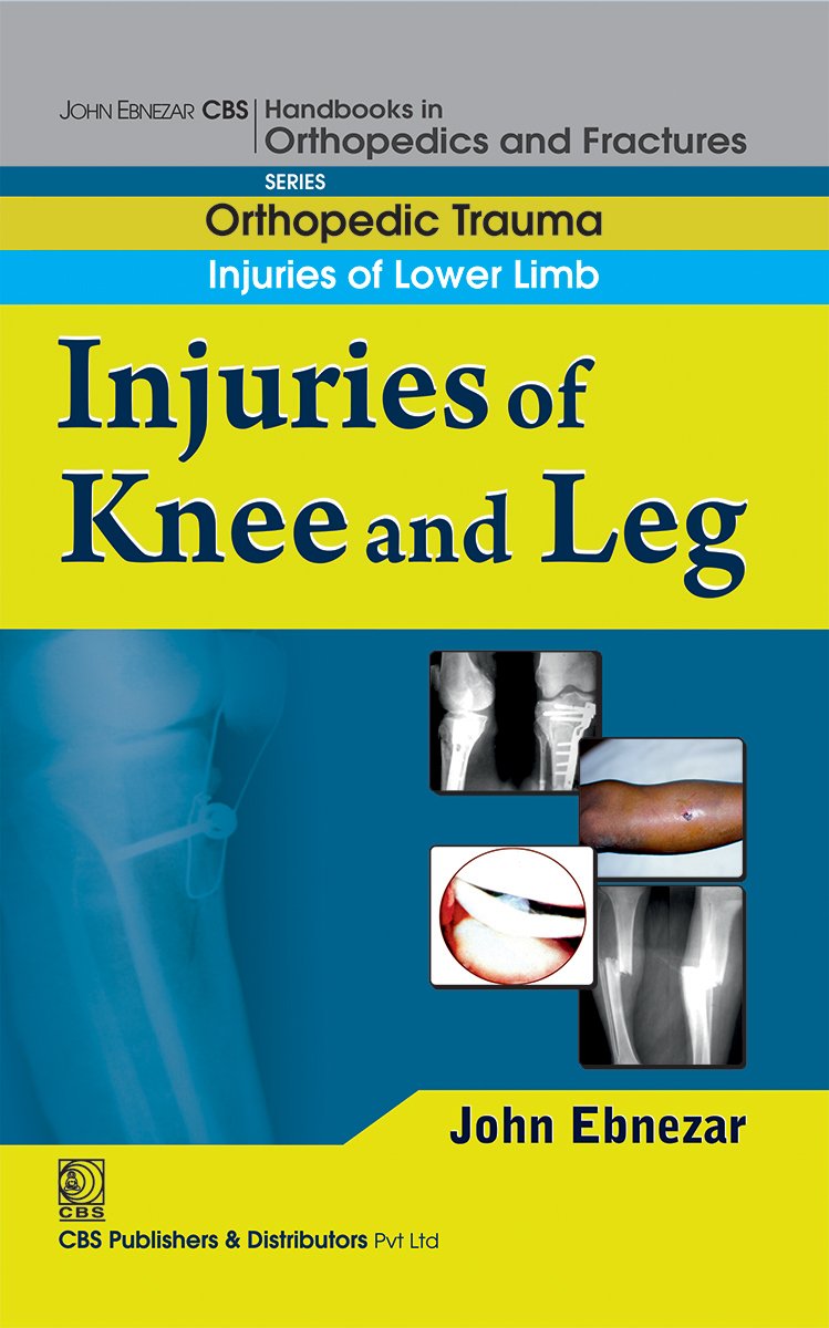 Amazon.com: Orthopedic Trauma INJURIES OF LOWER LIMB Injuries of Knee ...
