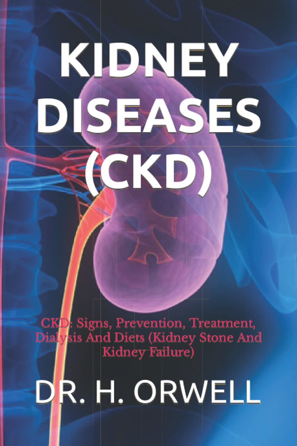 Buy KIDNEY DISEASES (CKD): CKD: Signs, Prevention, , Dialysis And Diets ...