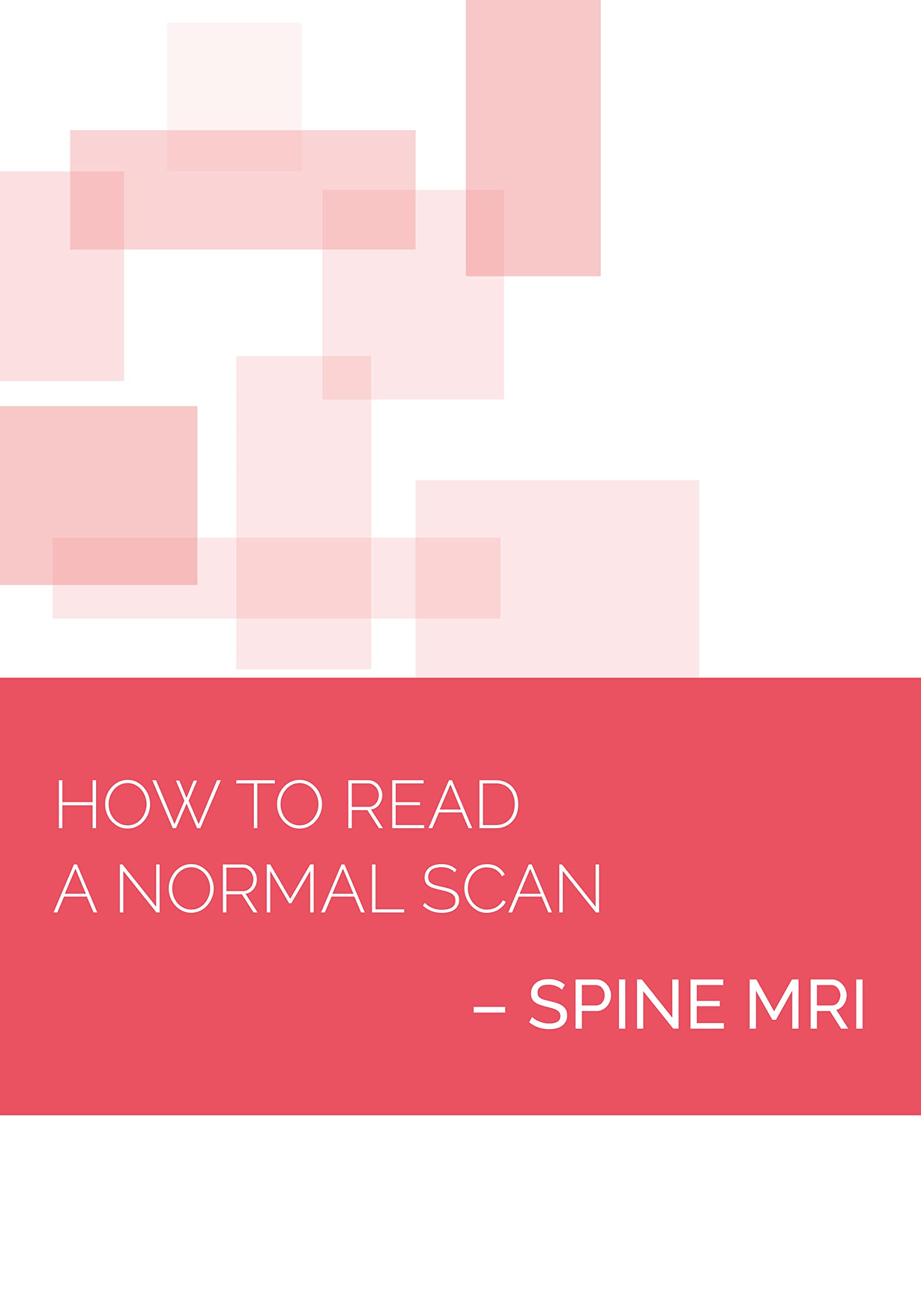 Buy How To Read A Normal Scan Spine MRI NEURORADIOLOGY How To Read A buy-how-to-read-a-normal-scan-spine-mri-neuroradiology-how-to-read-a