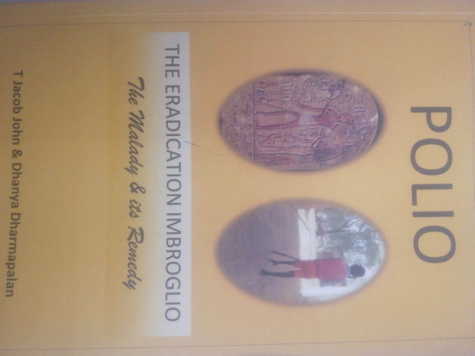 POLIO : THE ERADICATION IMBROGLIO : The Malady & its Remedy : T Jacob ...