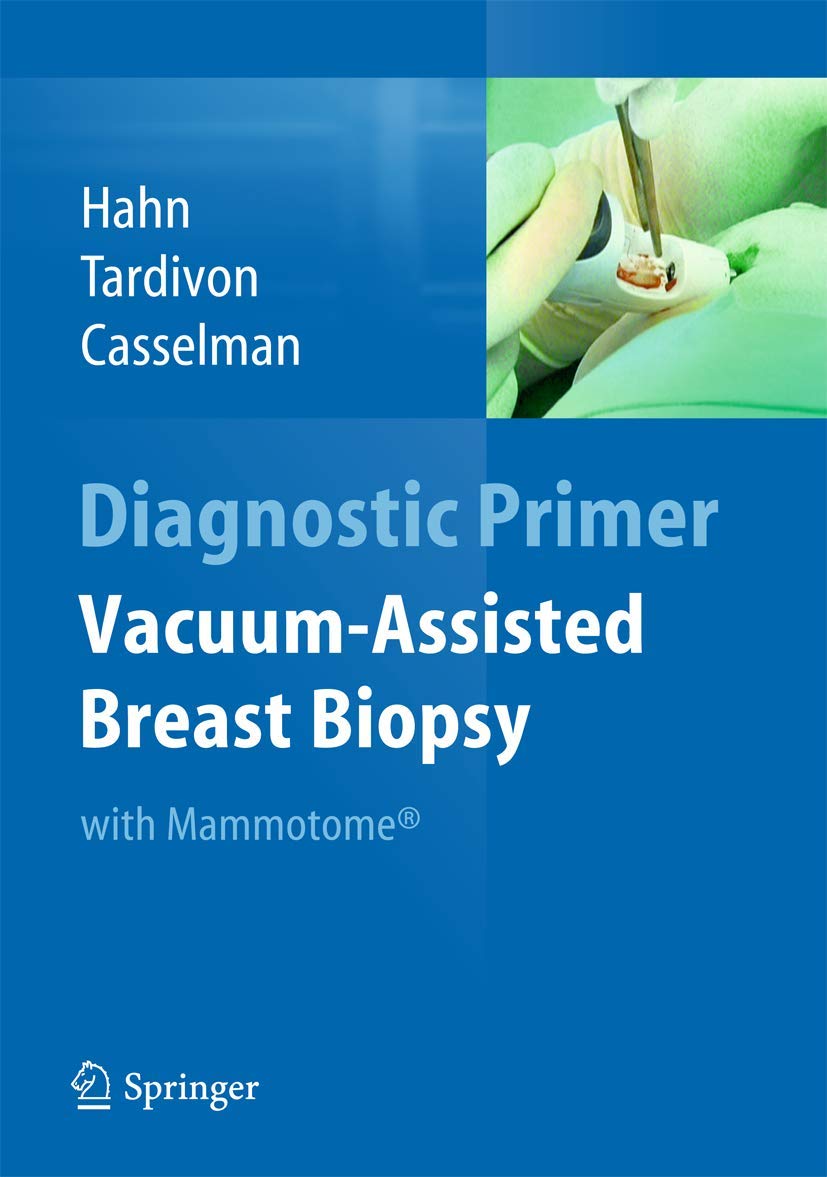 Buy Vacuum-Assisted Breast Biopsy with Mammotome(R) (Diagnostic Primer ...