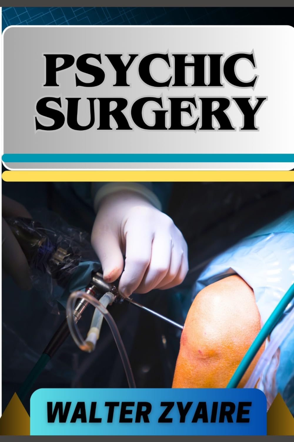 Psychic Surgery: A Complete Guide For Embracing Responsibility And ...