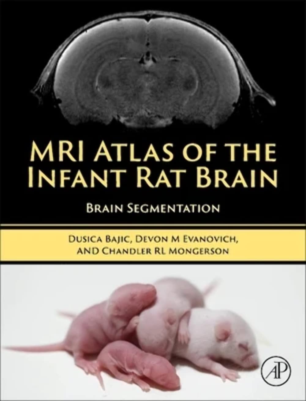MRI Atlas of the Infant Rat Brain: Brain Segmentation: 9780323997676 ...