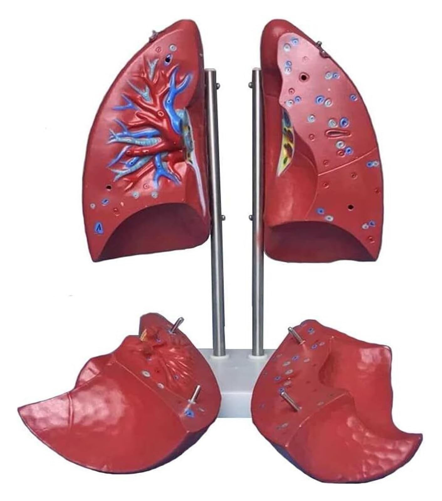Modelo De Pulmón Tratamiento Del Cáncer De Pulmón De Células No